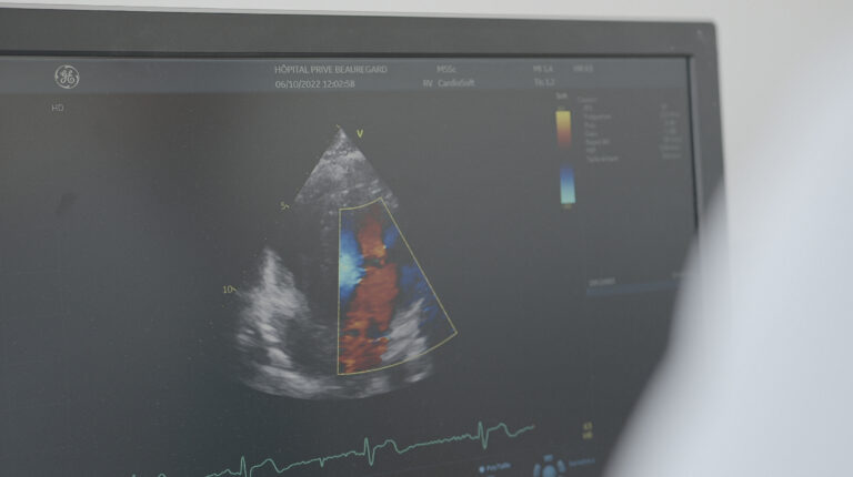Scanner Cardiaque - Urgence Cardiologiques Marseille